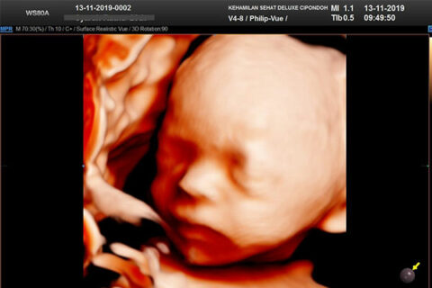Klinik Kandungan untuk Tempat USG Terbaik dengan Fasilitas Rumah Sakit