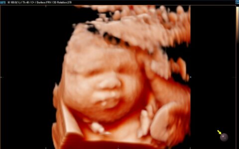 USG 2D: Pemeriksaan Kehamilan Dasar untuk Pantau Janin Awal