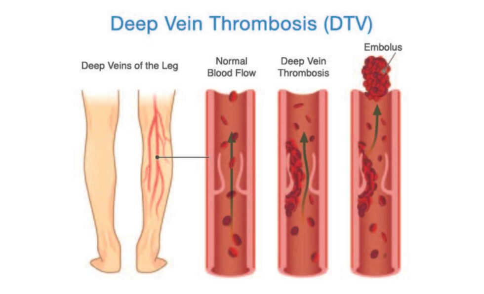 Larangan Masa Nifas yang Wajib Diketahui oleh Ibu Baru