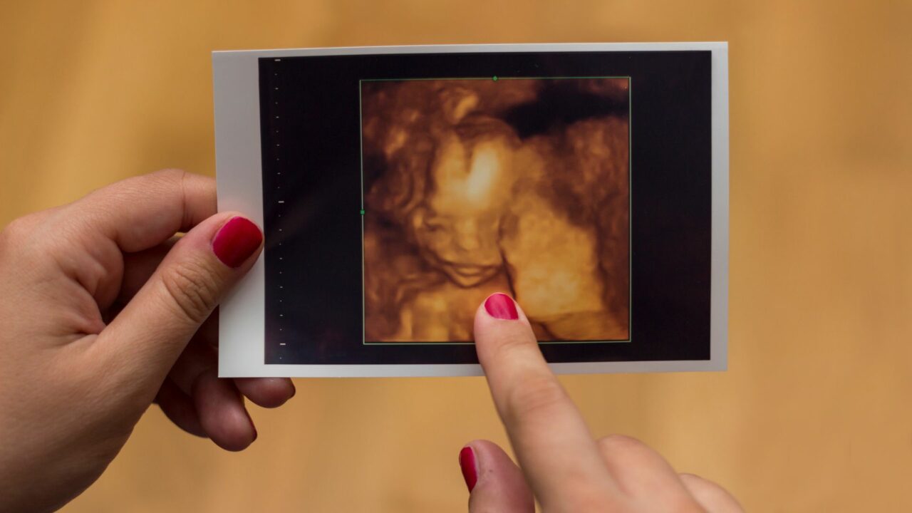 USG 2D: Pemeriksaan Kehamilan Dasar untuk Pantau Janin Awal