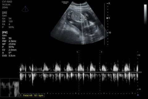 Klinik Kandungan untuk Tempat USG Terbaik dengan Fasilitas Rumah Sakit