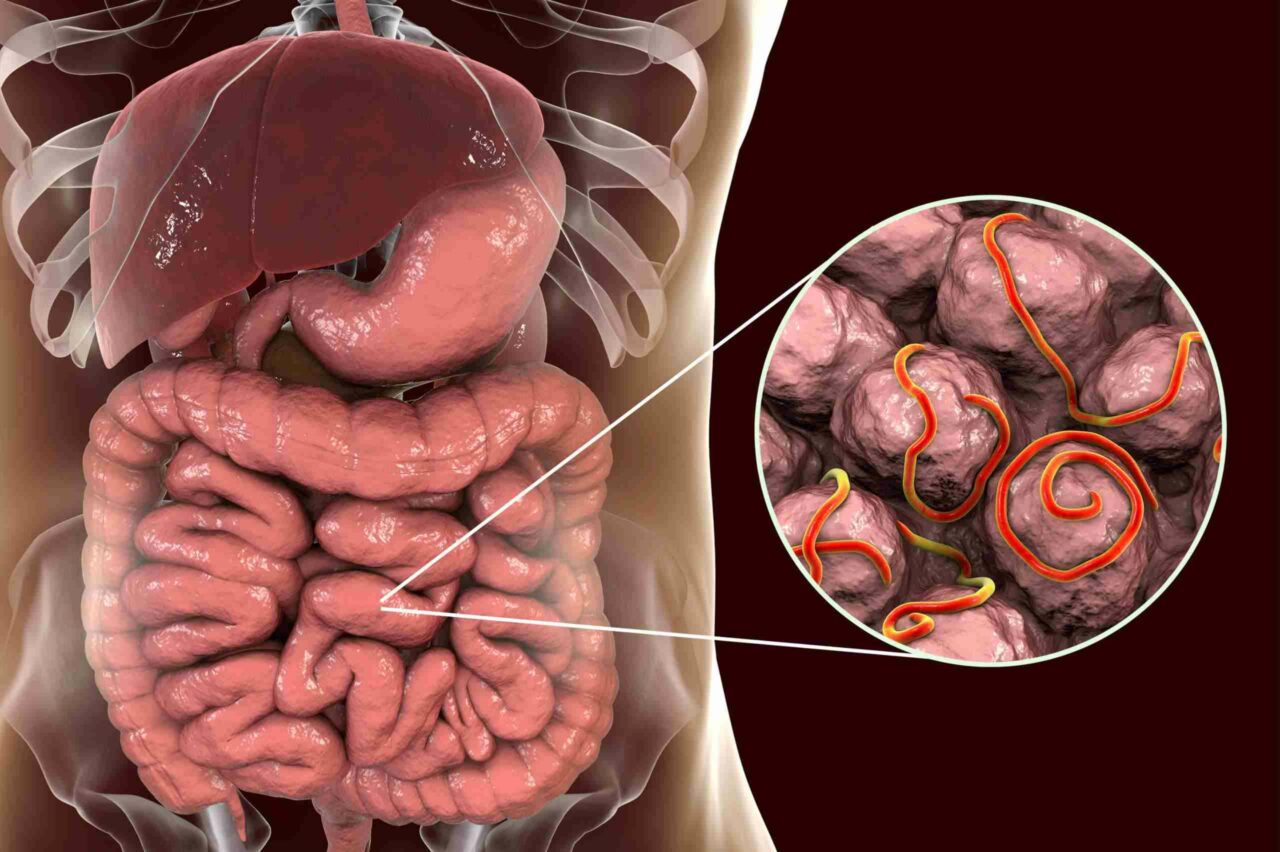 Waspada Ciri-Ciri Anak Cacingan yang Wajib Diketahui!