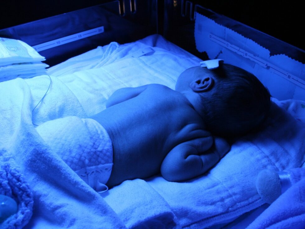 Bayi Kuning: Apa Penyebab dan Cara Mengatasinya