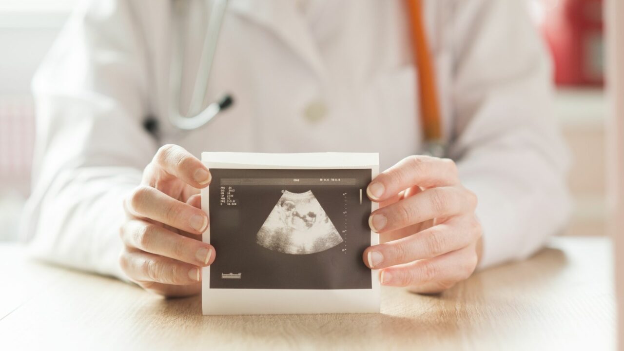 Cara Membaca Hasil USG Tidak Hamil, Apa Saja Tanda-Tandanya?