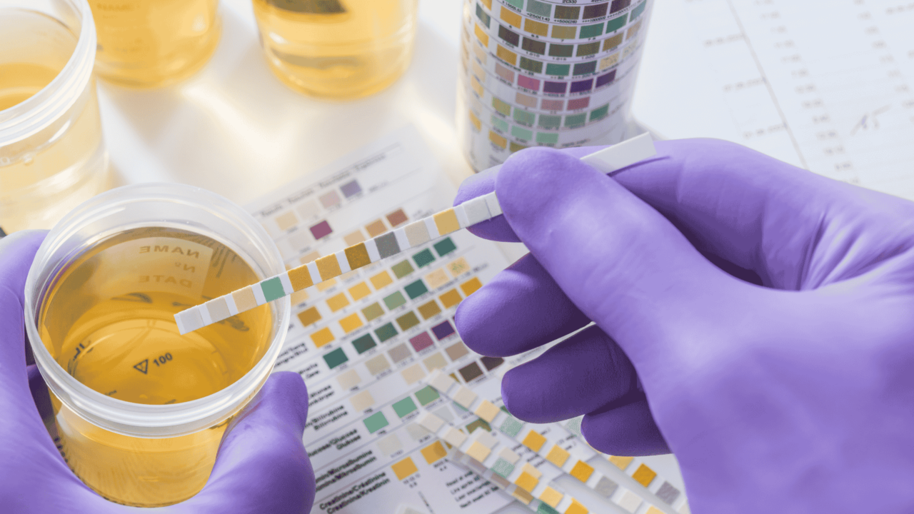 Kenali Tanda-Tanda Infeksi Saluran Kemih pada Anak Sejak Dini