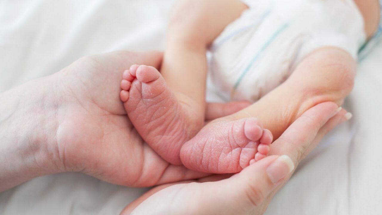 Apa Itu CTEV pada Bayi? Ketahui Cara Menyembuhkan Kaki CTEV!