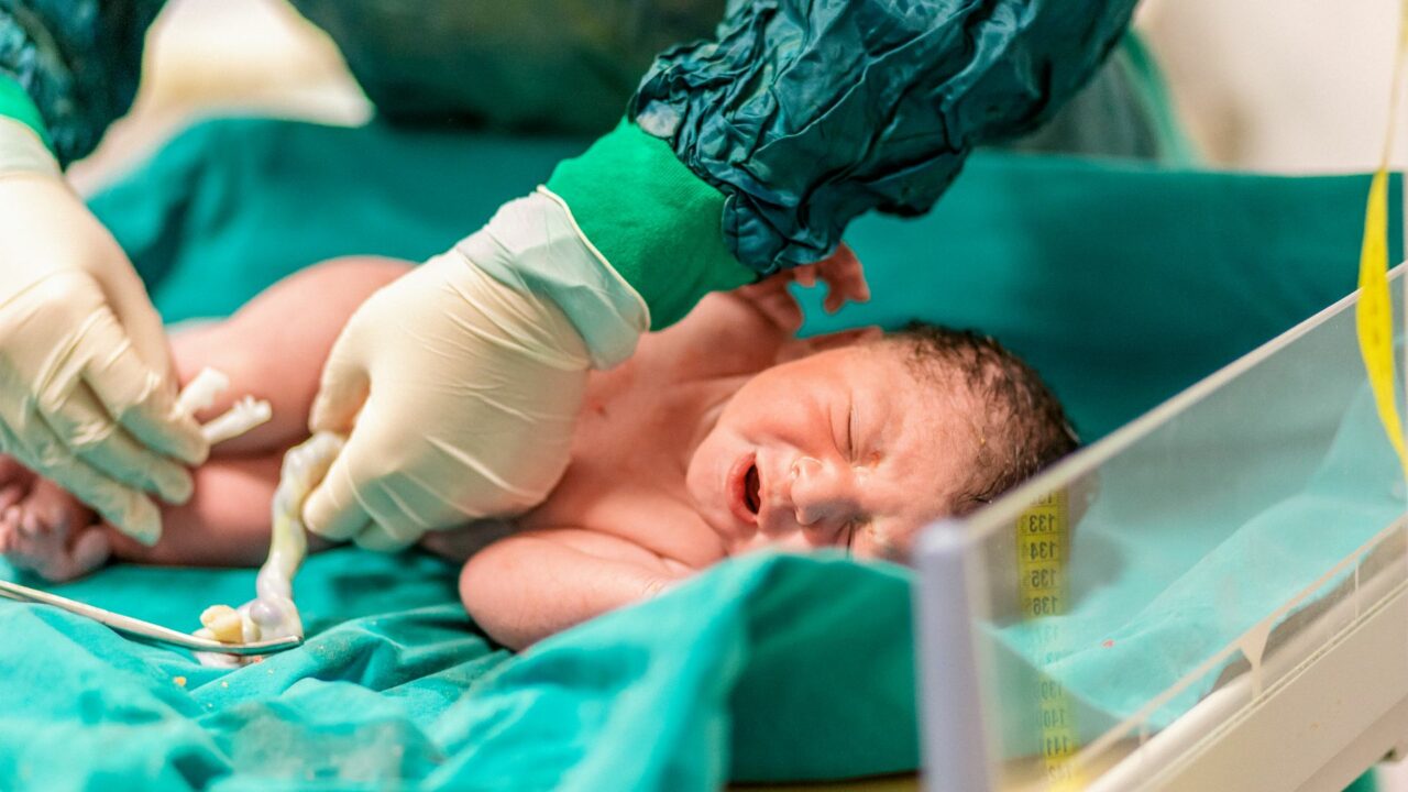 Prolaps Tali Pusat Bisa Terjadi Saat Persalinan, Ini Tandanya!