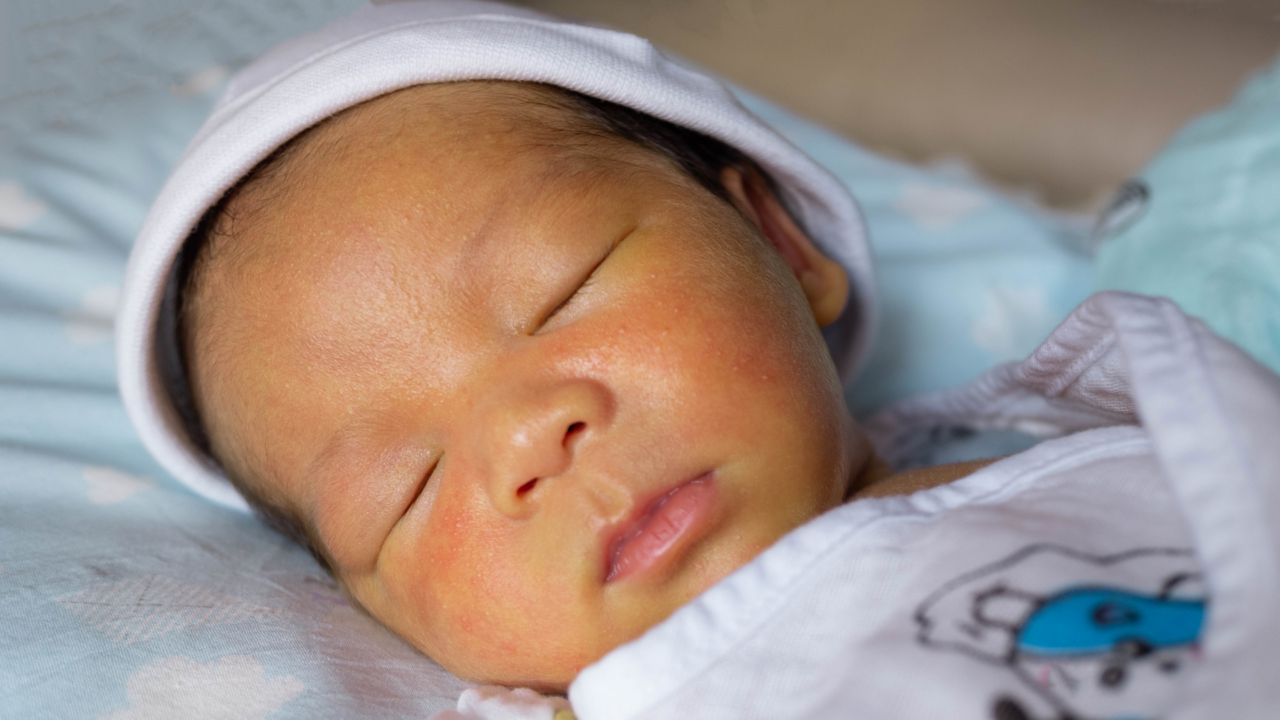 Ikterus Adalah Warna Kuning pada Kulit Bayi, Apa Penyebabnya?