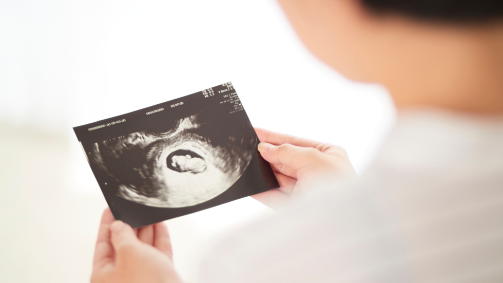 Mengenal Letak Janin 4 Bulan: Apa yang Perlu Diperhatikan!